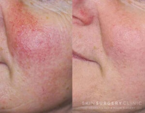 Good Skin Days - Multi-Award-Winning Medical Skin Clinic in Leeds
